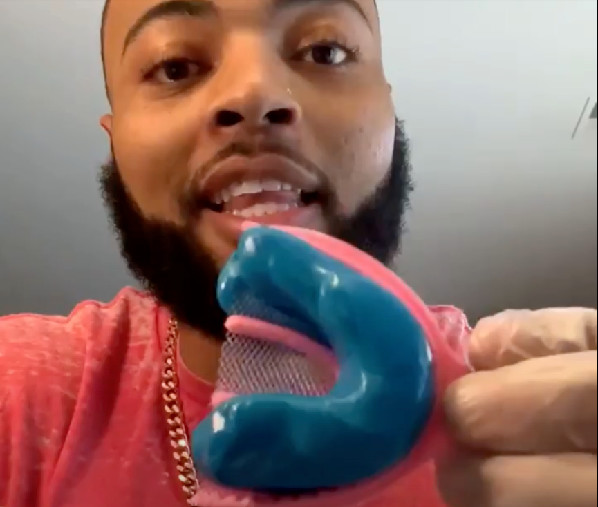 Tevin's Journey – Pop On Veneers