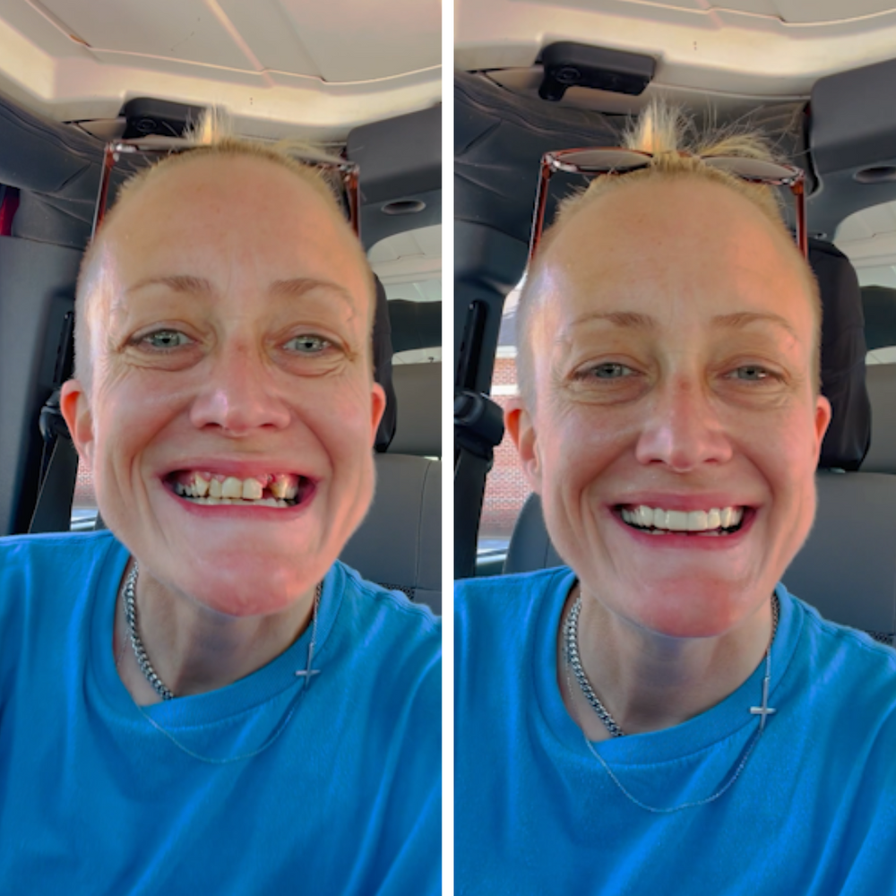 Celebrating Smiles – Page 15 – Pop on Veneers