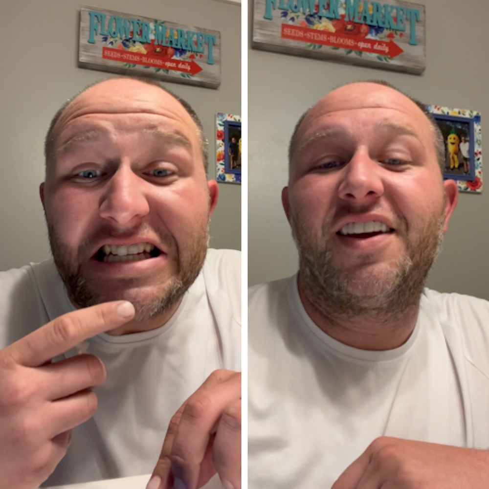 Celebrating Smiles – Page 12 – Pop on Veneers