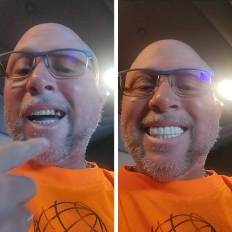 Perfect Smile with Pop On! - Jorge C. – Pop On Veneers