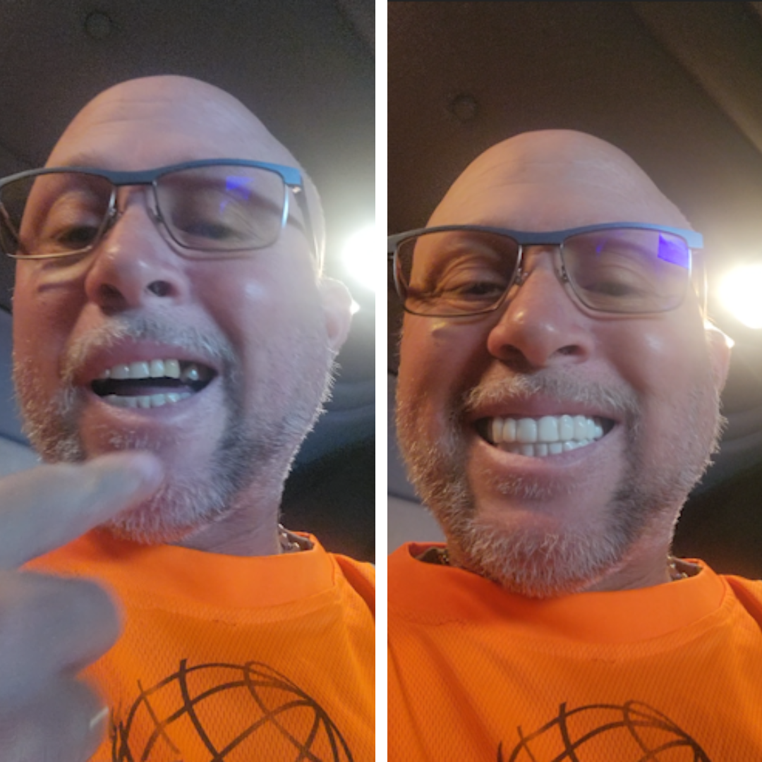 Perfect Smile with Pop On! - Jorge C. – Pop on Veneers