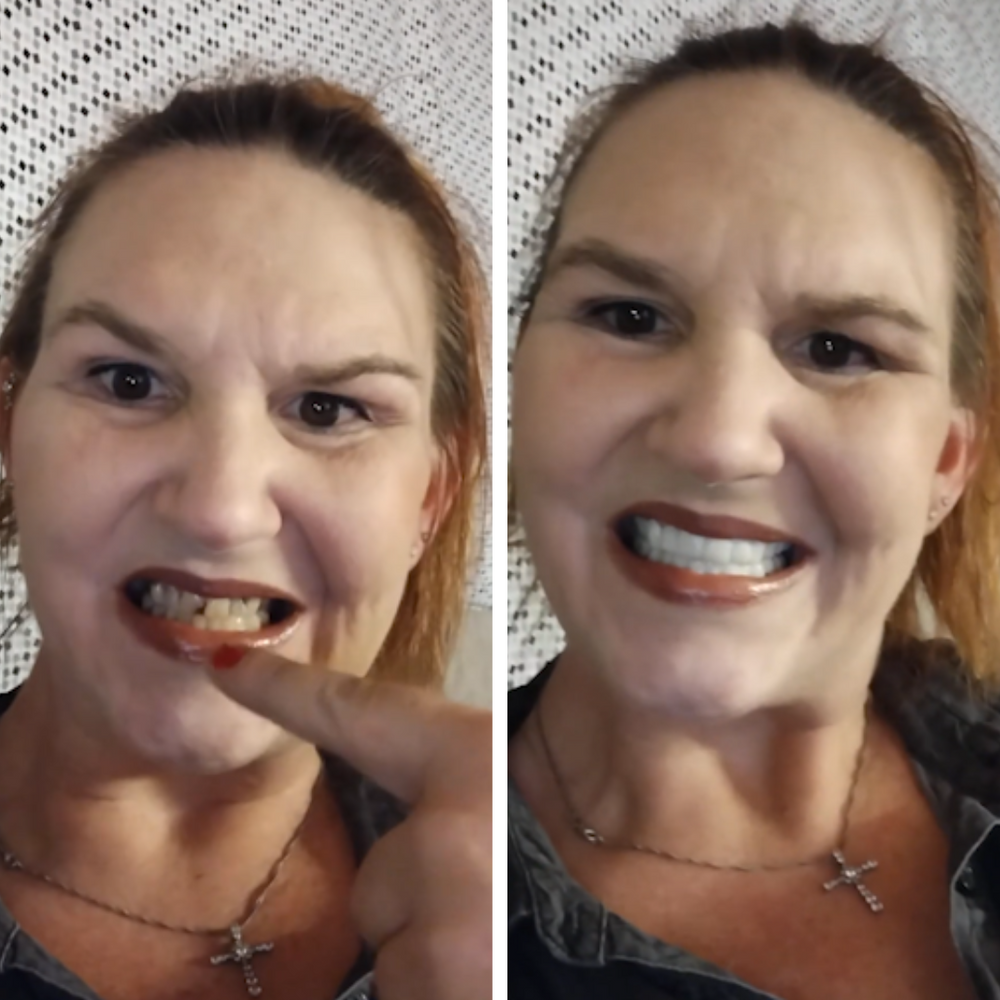 Celebrating Smiles – Page 12 – Pop on Veneers