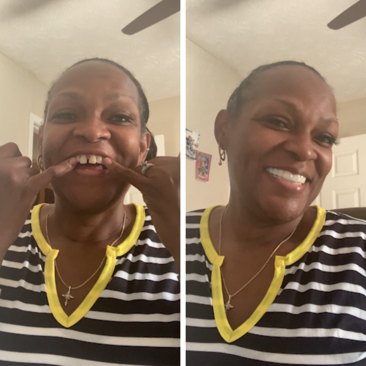 Can’t take the smile off my face! – Pop On Veneers