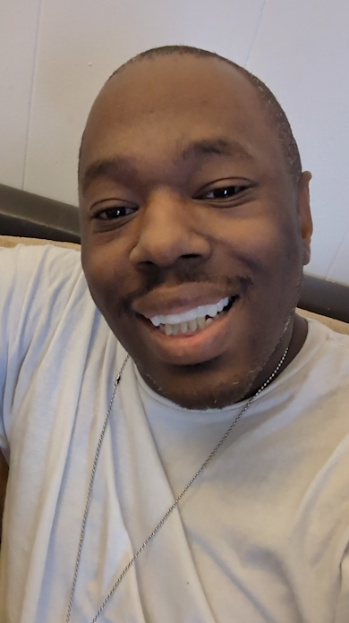 My confident, natural new smile! – Pop on Veneers