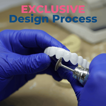 Cosmetic snap on veneers with at home impression kit – Pop On Veneers