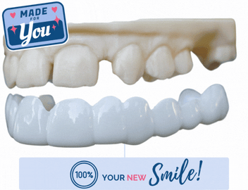 Pop On & Smile With Confidence – Pop On Veneers