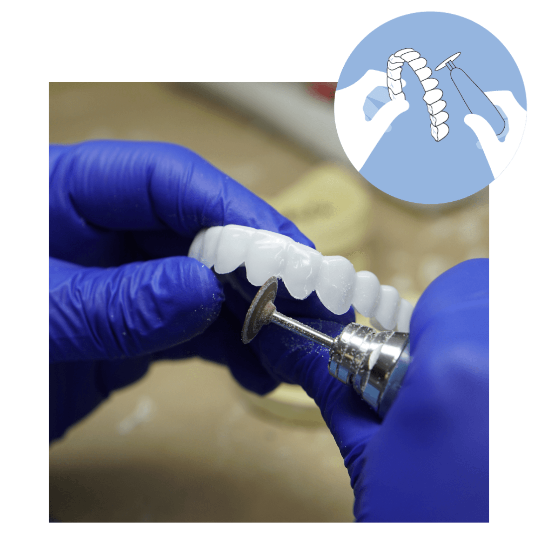 Pop On & Smile With Confidence – Pop On Veneers