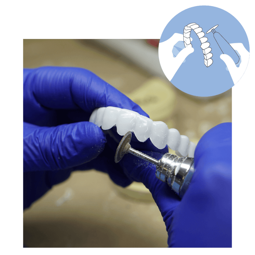 Pop On & Smile With Confidence – Pop On Veneers