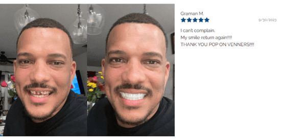 Absolutely WOW! – Pop On Veneers