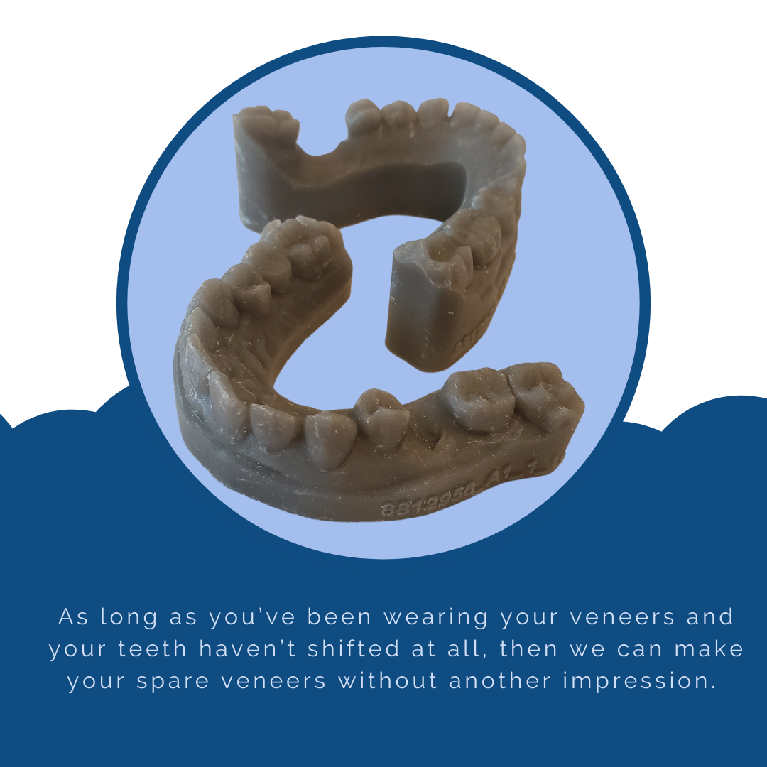 Cosmetic snap on veneers with at home impression kit – Pop on Veneers